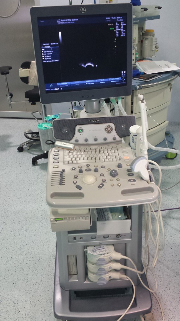 Ecografía Transrectal o Endorrectal
